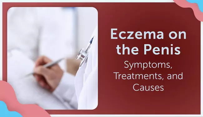 Eczema on the Penis: Symptoms, Treatments, and Causes | MyEczemaTeam