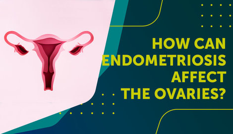 Endo Belly: Managing Bloating in Endometriosis | MyEndometriosisTeam