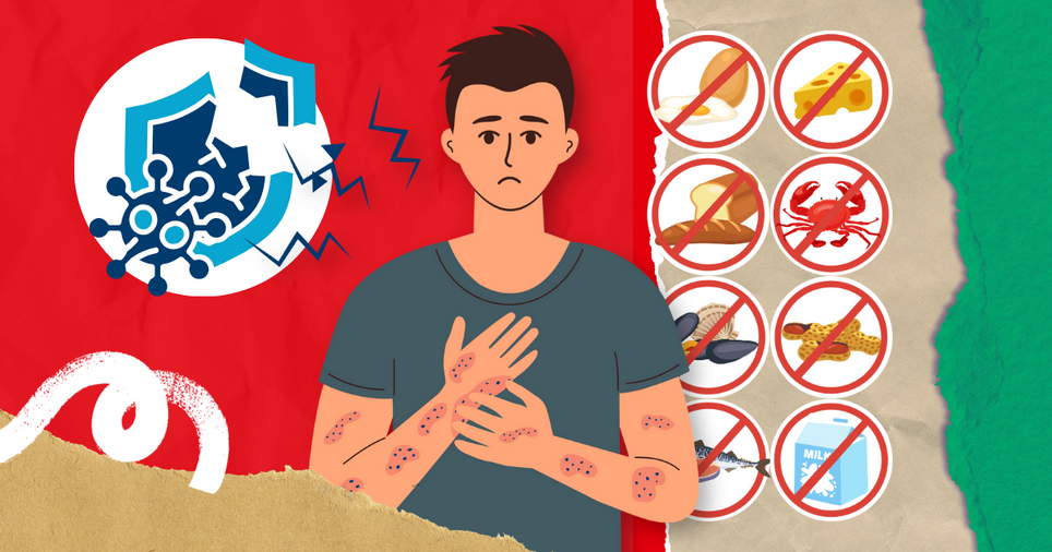 Eczema Information | MyEczemaTeam