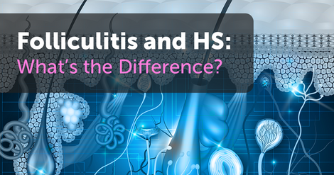 Hidradenitis Suppurativa vs. Herpes: What’s the Difference? | myHSteam