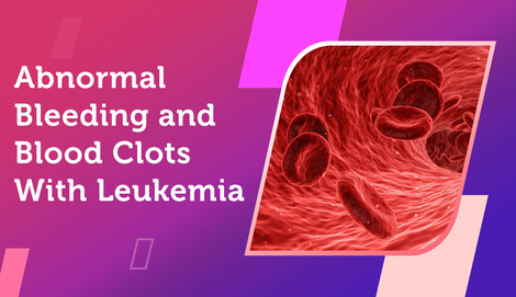 7 Causes of Leukemia Fatigue and 4 Ways To Manage It | MyLeukemiaTeam