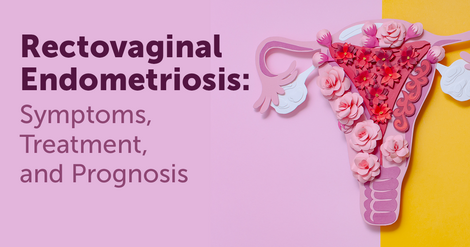 Deep Infiltrating Endometriosis: Diagnosis and Treatment ...