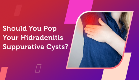 Hidradenitis Suppurativa Stage 1: Pictures and Treatment | myHSteam