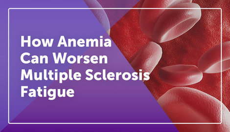 What Is Multiple Sclerosis | MyMSTeam