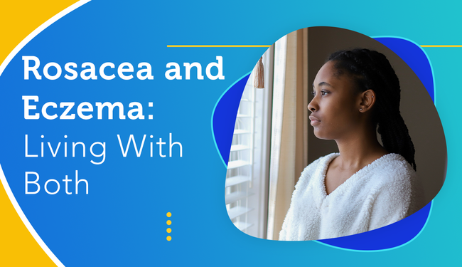 Eczema Information | MyEczemaTeam