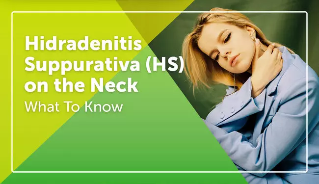 Hidradenitis Suppurativa (HS) on the Neck: What To Know | myHSteam