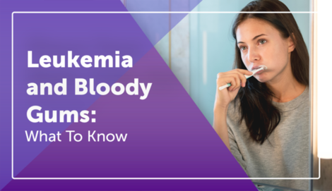 Leukemia Fever Pattern: When Should You Worry? | MyLeukemiaTeam