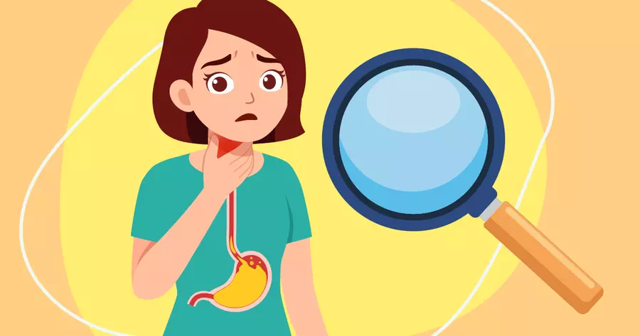 GERD vs. EoE: Differences in Treatment | myEoEcenter