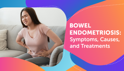 The 4 Stages of Endometriosis: Understanding the Progression ...