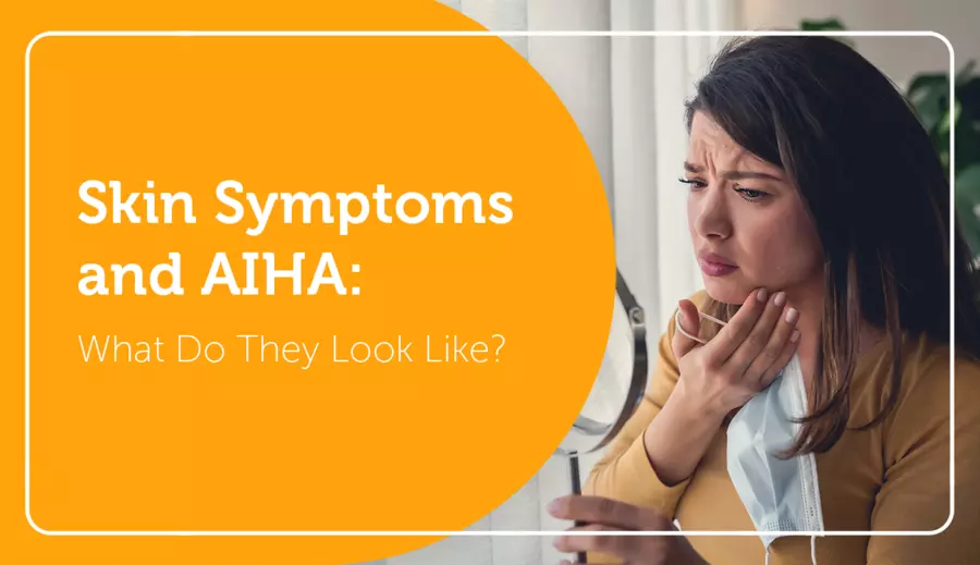 Skin Symptoms and AIHA: What Do They Look Like? | myAIHAteam