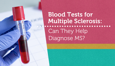 What Is the Average Age for a Multiple Sclerosis Diagnosis? | MyMSTeam