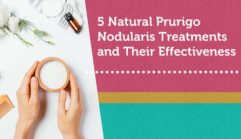 Prurigo Nodularis: An Overview | MyPrurigoTeam