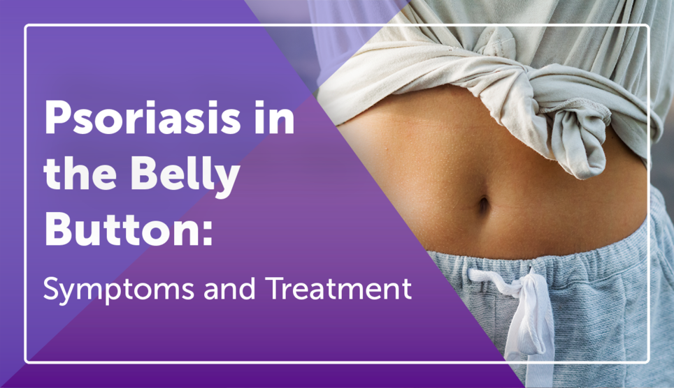 Psoriasis Symptoms | MyPsoriasisTeam