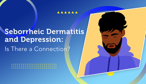 Stress and Seborrheic Dermatitis: What’s the Connection? | MySebDermTeam