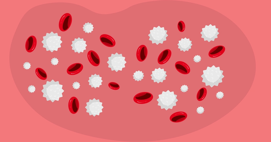 Complications of Untreated ITP: 4 Signs To Look for and 6 Ways To ...