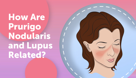 How Is Prurigo Nodularis Diagnosed? | MyPrurigoTeam