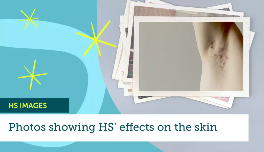 HS Connect Resource Center | myHSteam