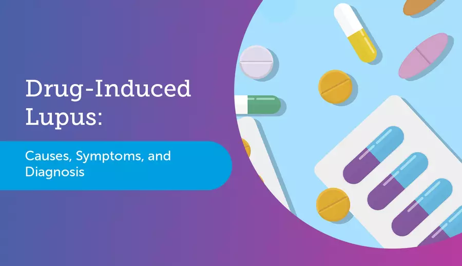 Drug-Induced Lupus: Causes, Symptoms, and Diagnosis | MyLupusTeam