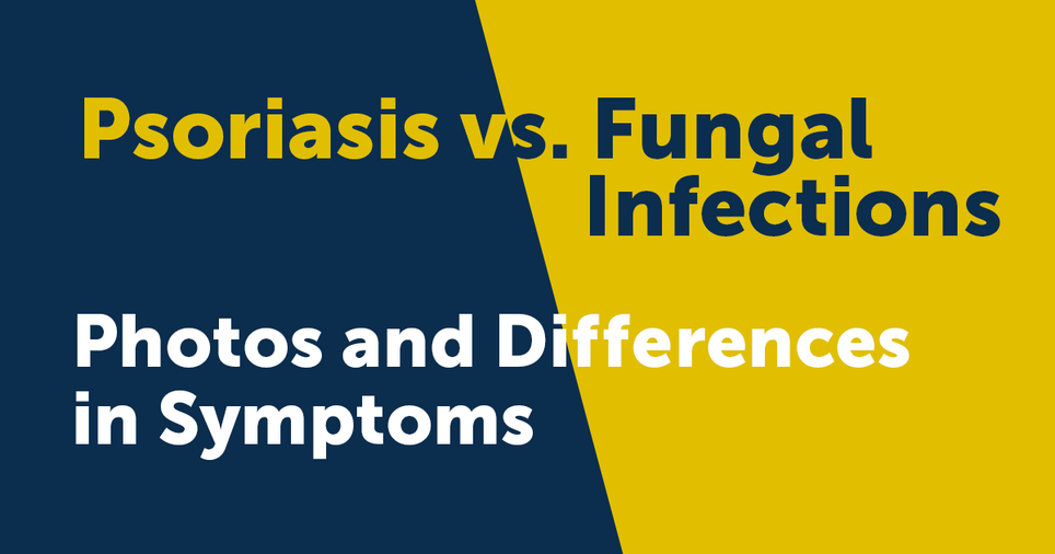 Related Conditions | MyPsoriasisTeam