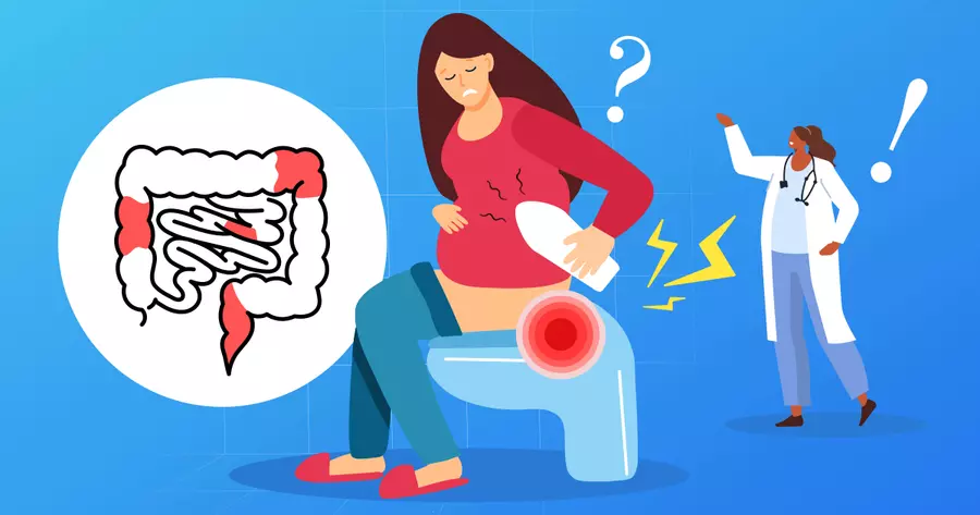 rectal suppository position