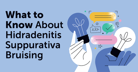 Hidradenitis Suppurativa (HS) Pain: Causes and Treatments | myHSteam