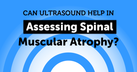 Carrier Screening for Spinal Muscular Atrophy | mySMAteam