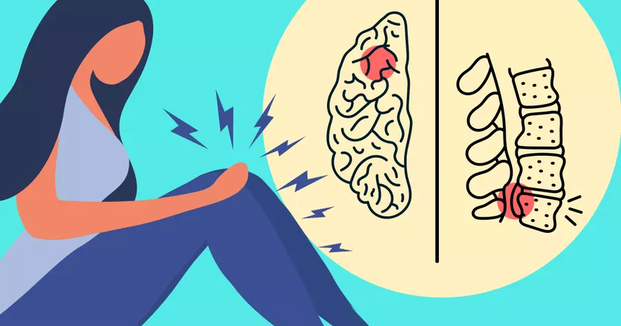 Shooting Pain Down One Leg: Is It MS or Sciatica? | MyMSTeam