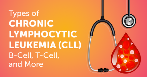 Chronic Myelomonocytic Leukemia: An Overview | MyLeukemiaTeam