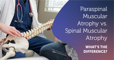 Types of Spinal Muscular Atrophy (SMA) | mySMAteam