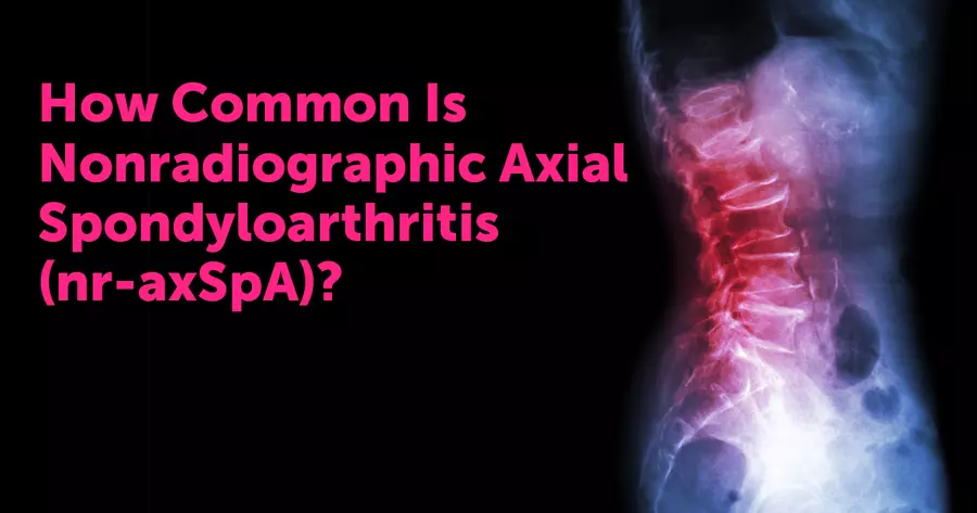 How Prevalent Is Nonradiographic Axial Spondyloarthritis (nr-axSpA ...