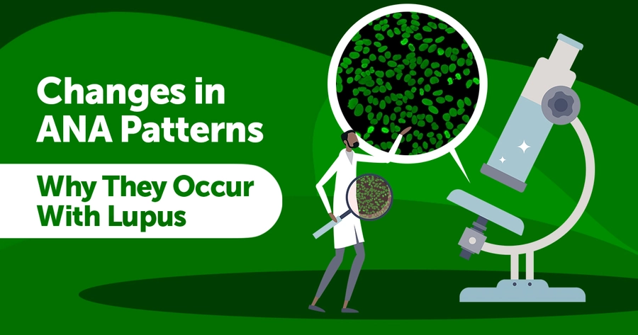 Changes in ANA Patterns: Why They Occur With Lupus | MyLupusTeam