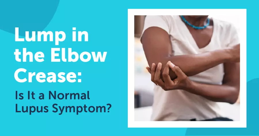 Lump in the Elbow Crease: Is It a Normal Lupus Symptom? | MyLupusTeam