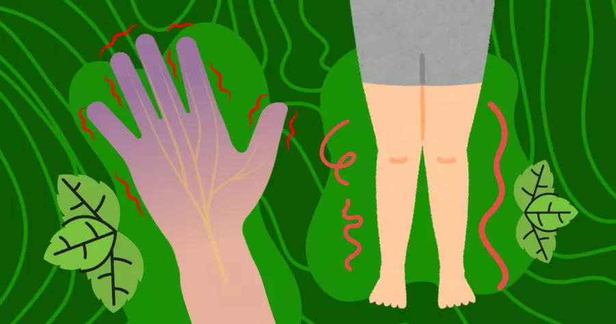 Can Lupus Cause a Cool, Tingly, Menthol Feeling in Your Arms or Legs ...