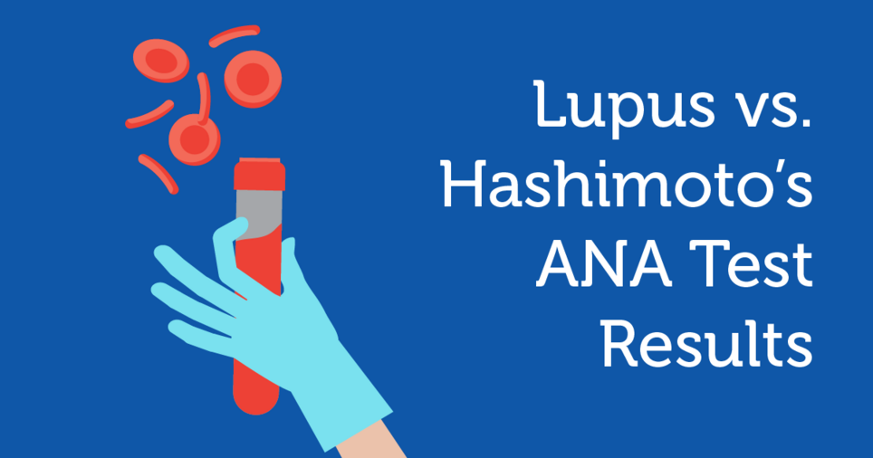 Lupus Information | MyLupusTeam