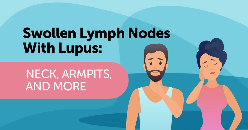 Physical Symptoms MyLupusTeam Physical Symptoms MyLupusTeam