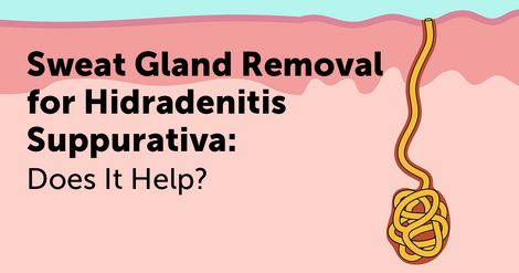 Spironolactone for Hidradenitis Suppurativa: How Does It Work? | myHSteam