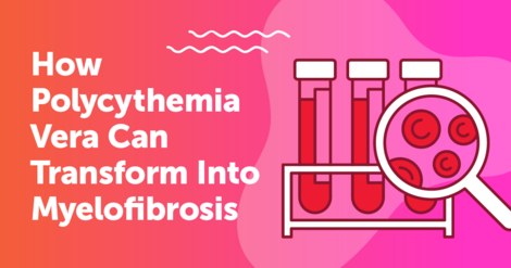 Supplements for Polycythemia Vera: 5 To Take and 3 To Avoid | myMPNteam