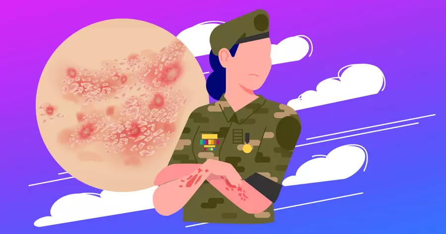 psoriasis army