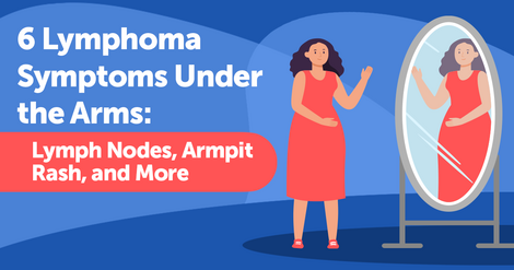 Lymphoma Symptoms in Women: 6 Signs That Are Easy To Miss | MyLymphomaTeam