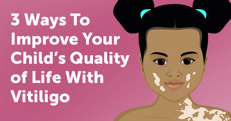 Treating Vitiligo in Children: Your Guide | MyVitiligoTeam