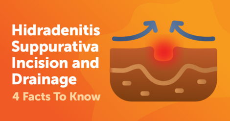 Hidradenitis Suppurativa Tunnels: What To Know | myHSteam
