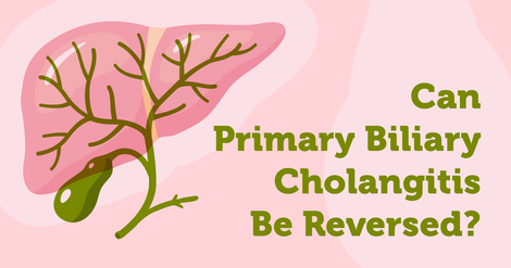 Living With PBC: 8 Tips for Managing Symptoms | myPBCteam