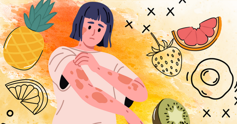 Can You Have a Coffee Allergy? Symptoms, Testing, and More ...