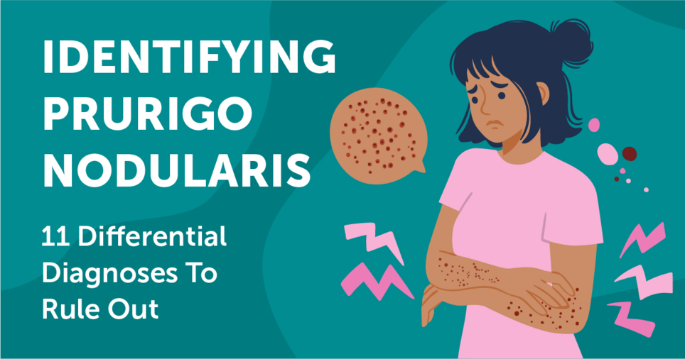 The social network for those living with prurigo nodularis. | MyPrurigoTeam