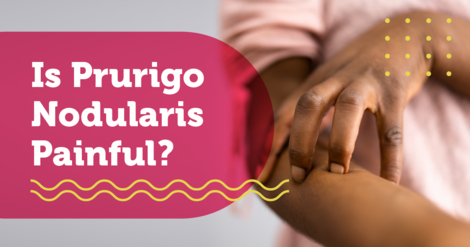Identifying Prurigo Nodularis: 11 Differential Diagnoses To Rule Out ...