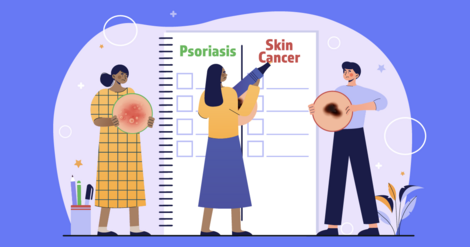 Can Psoriasis Cause Swollen Lymph Nodes? | MyPsoriasisTeam