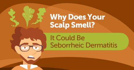 6 Conditions Related to Seborrheic Dermatitis | MySebDermTeam