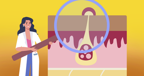 Vicks VapoRub for HS: Can It Help Get Rid of Boils? | myHSteam