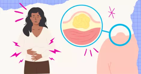 9 Desmoid Tumor Symptoms To Watch For | MyDesmoidTumorTeam