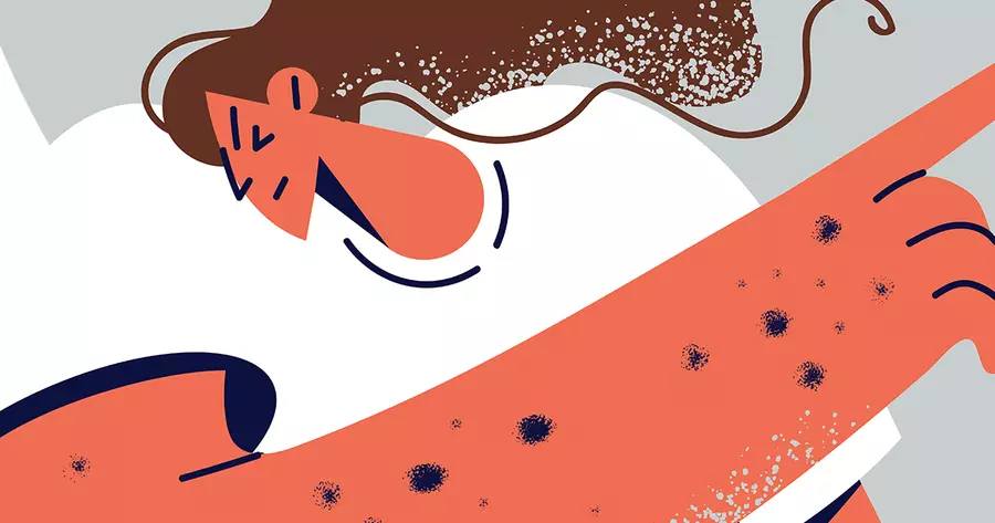 Acral Lentiginous Melanoma: Risk Factors, Prognosis, and Treatments ...